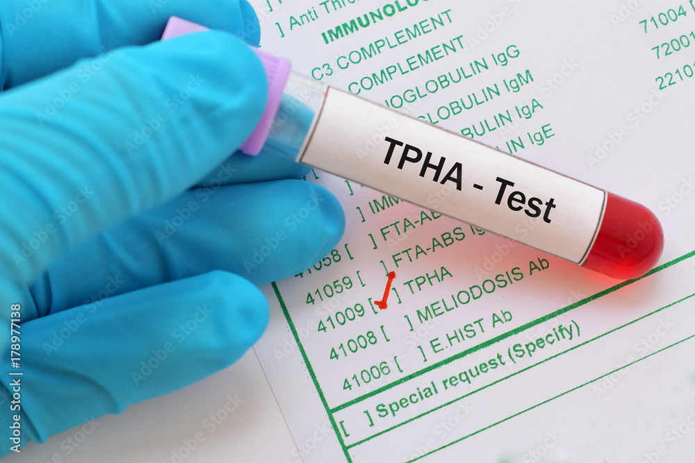 Blood sample with requisition form for TPHA test, diagnosis for ...