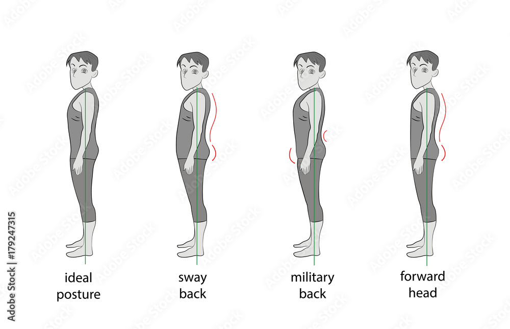 types of posture in men. vector illustration. Stock Vector | Adobe Stock