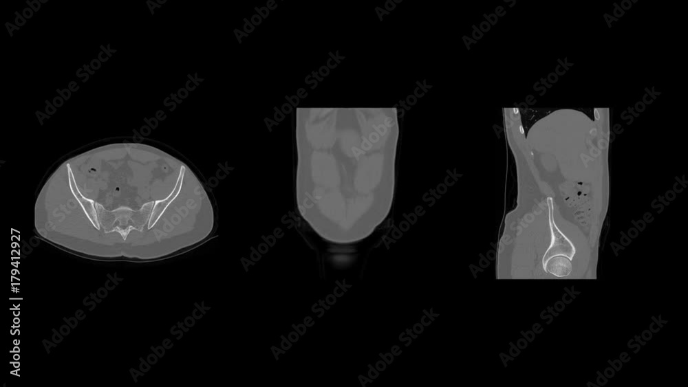 Raw CT scan DICOM images of human body, radiography x-ray examination ...
