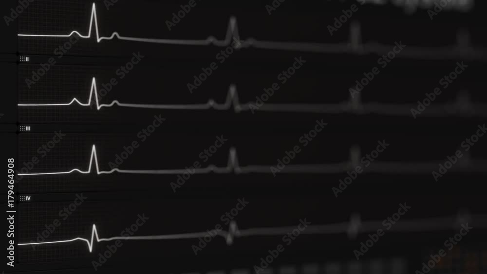 Vidéo Stock ECG waves on monitor in perspective with DOF. Computer ...