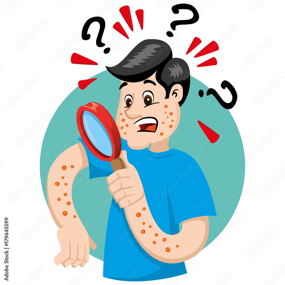 Mascot bob man person, with allergy, rashes and dermatitis, symptom ...