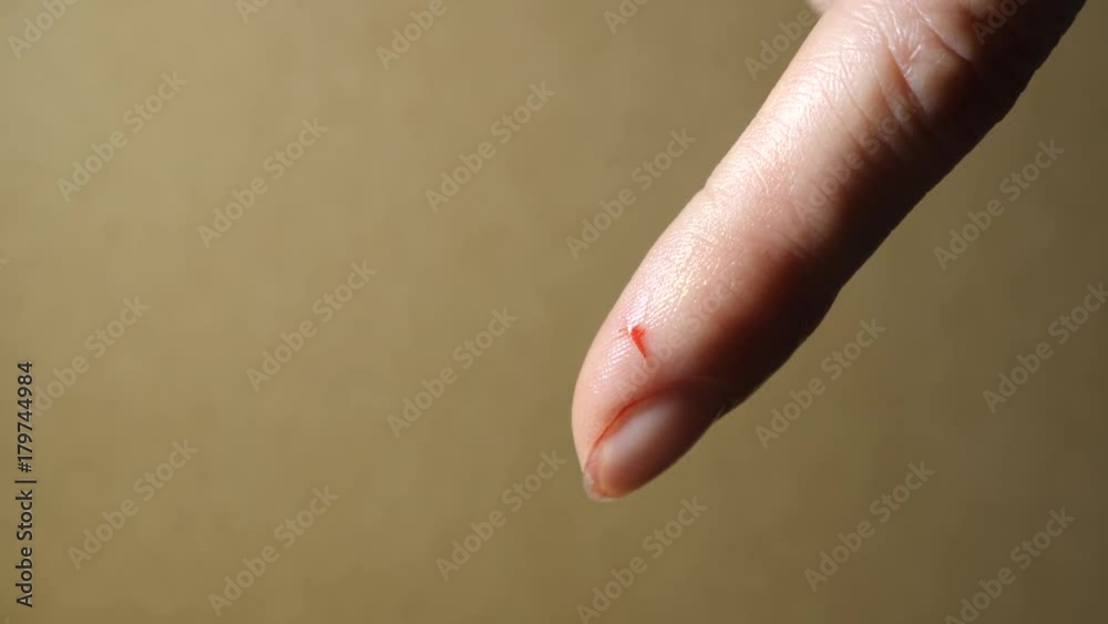 the blood flowing out of the wound on the woman's index finger. 4k ...
