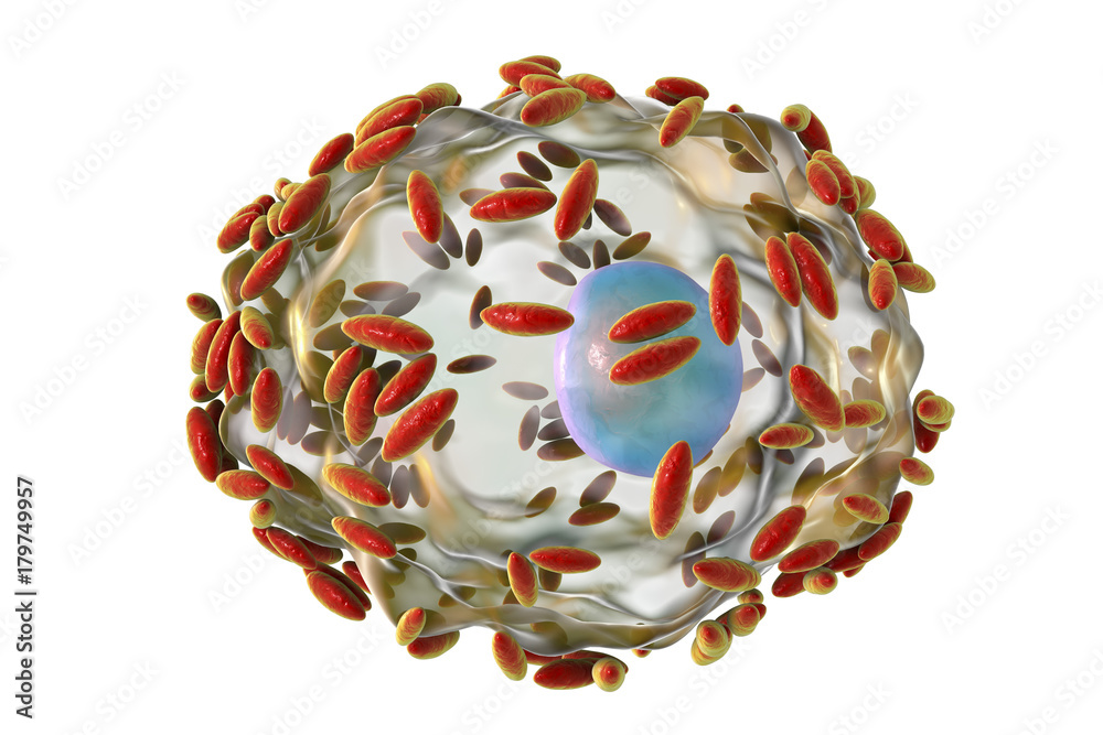 Microscopic diagnosis of bacterial vaginosis. Vaginal secretions ...