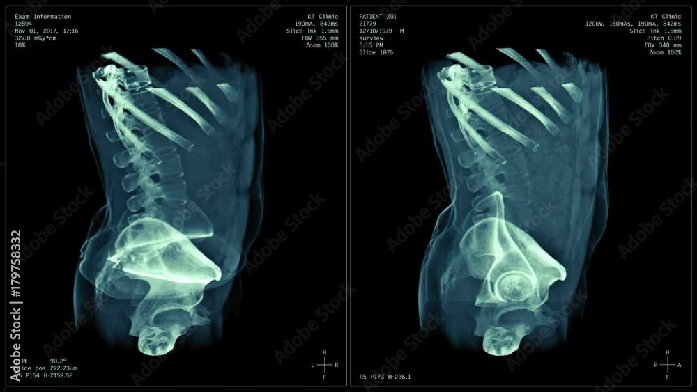 Body CT scan image, radiography x-ray examination, MRI tomography ...