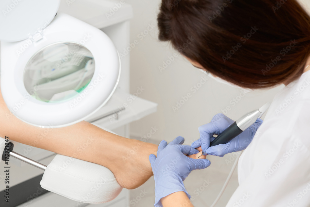 Professional hardware pedicure using electric machine.Patient on ...