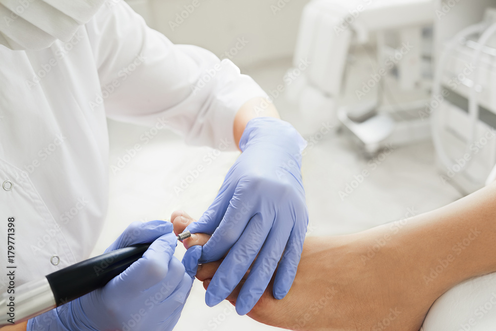 Professional hardware pedicure using electric machine.Patient on ...