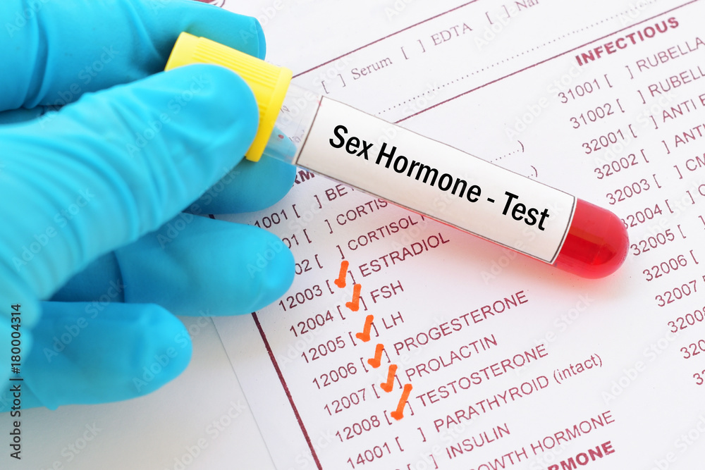 Blood sample with requisition form for sex hormone test Stock-Foto ...