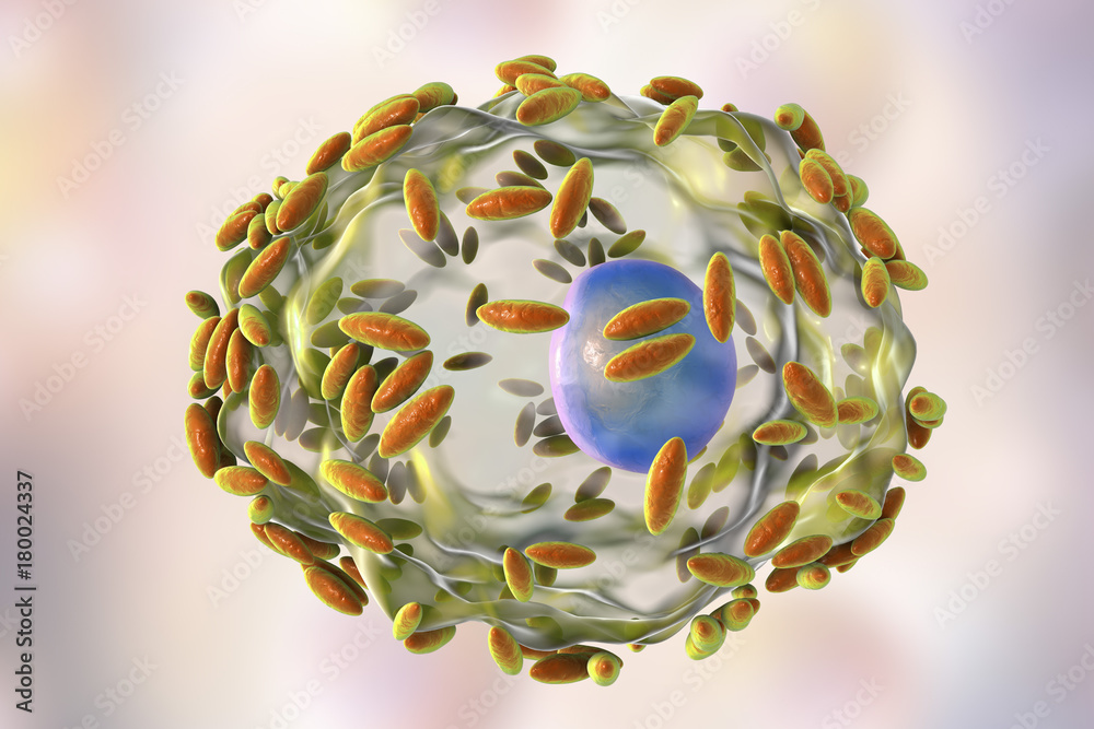 Microscopic diagnosis of bacterial vaginosis. Vaginal secretions ...