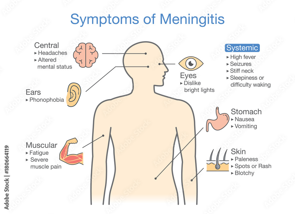 Symptoms of Meningitis patient. Diagram to showing signs of disease ...