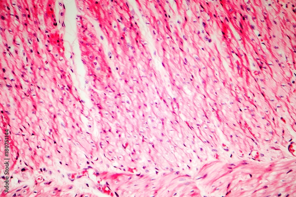 Smooth Muscle Cross Section