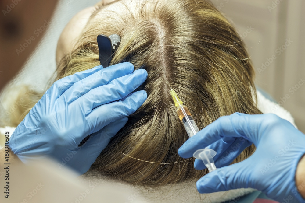 The procedure for treating hair from falling out by injection. The ...