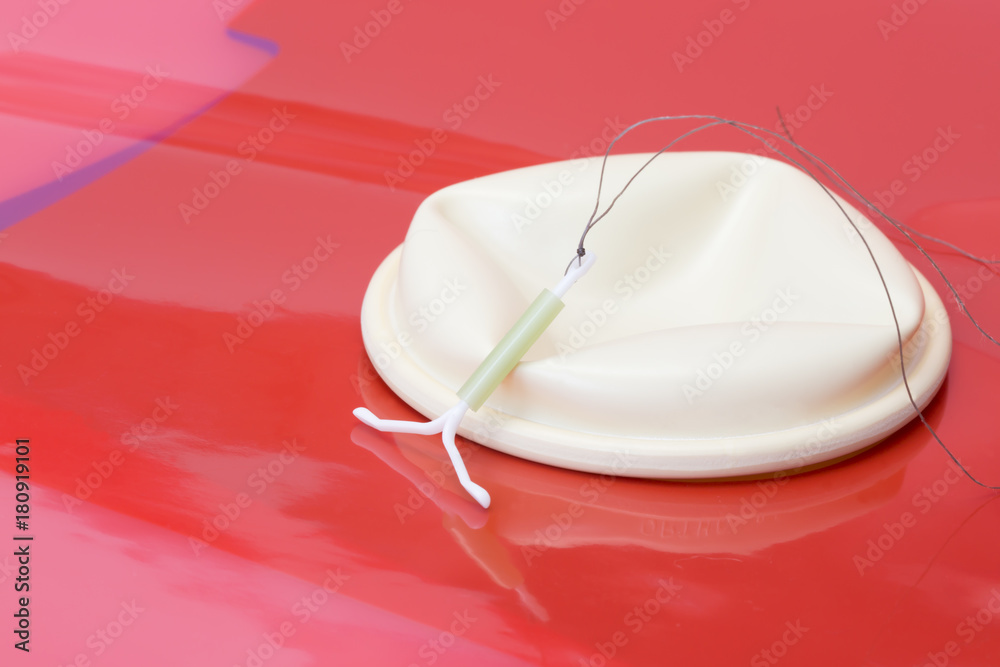 Contraceptive diaphragm and intrauterine system Stock Photo | Adobe Stock