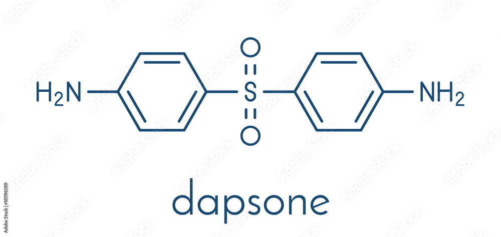 Dapsone antibacterial drug molecule. Skeletal formula. Stock Vector ...