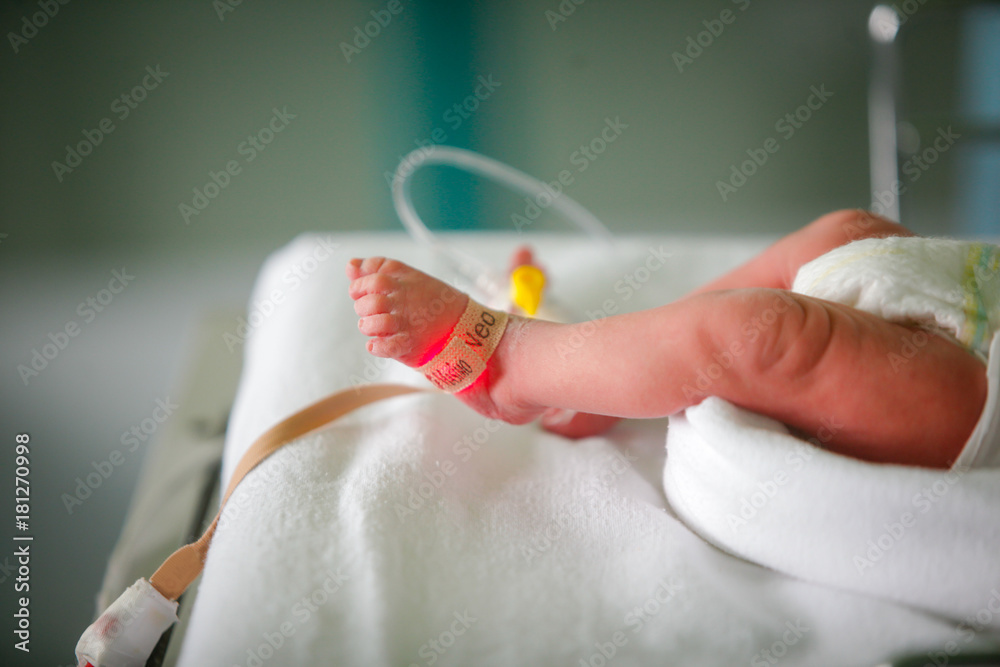 Preterm baby Stock Photo | Adobe Stock
