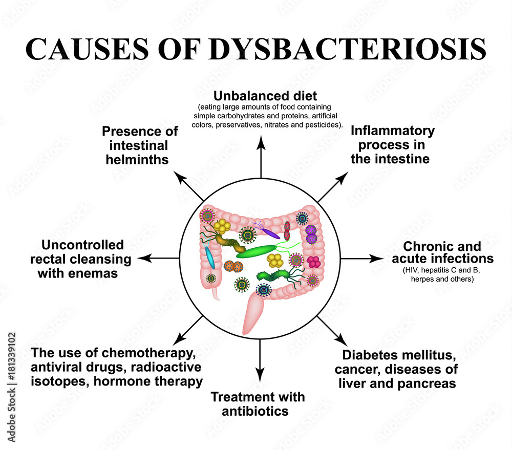The causes of dysbiosis in the intestines. Colon. Bacteria pathogenic ...