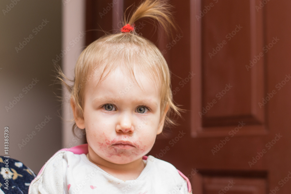 beautiful girl child with a broken bloody face after falling while ...