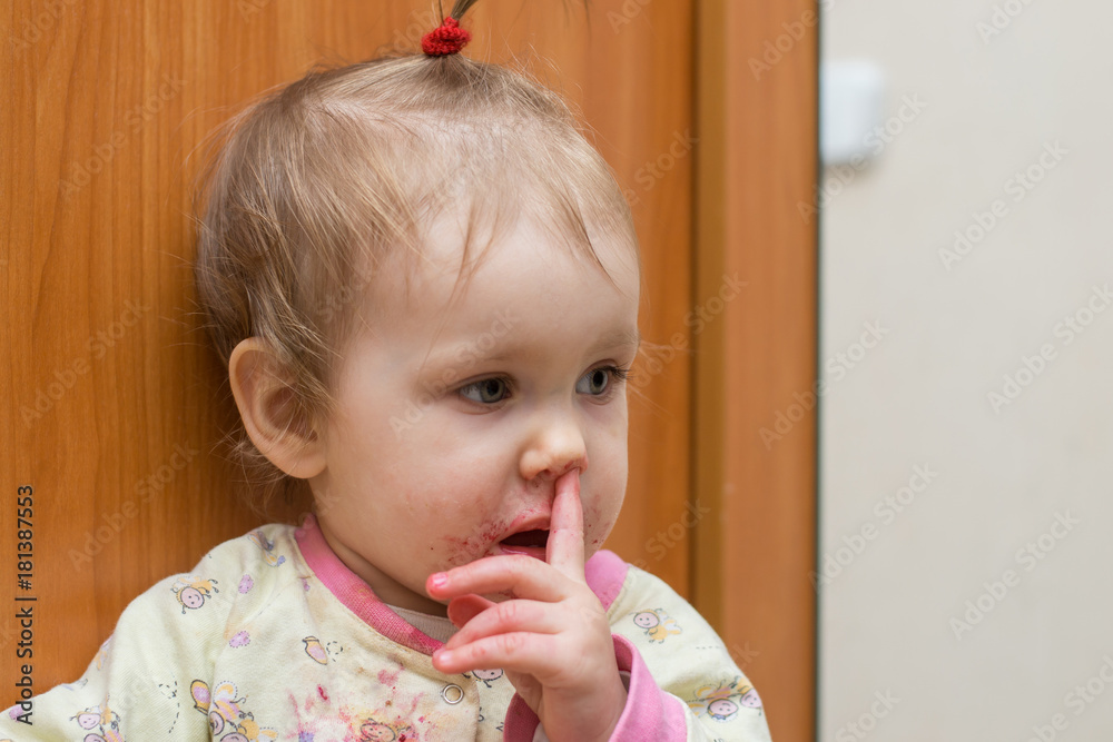 beautiful girl child with a broken bloody face after falling while ...