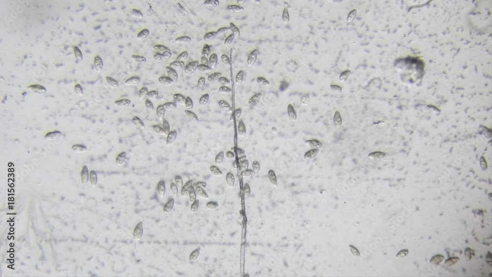 Microscope image footage of protozoa microorganisms in water, showing ...