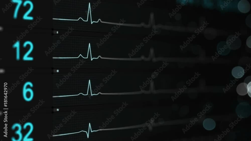 Medical monitor with blue lines of ECG. Abstract healthcare concept ...