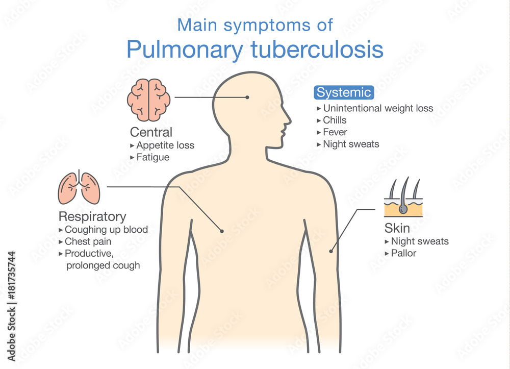 Tuberculosis Patient
