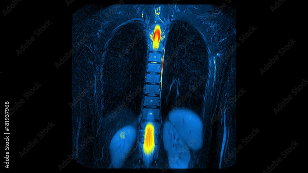 Computed medical tomography MRI upscaled scan of healthy young female ...