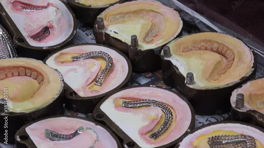 Dental molds in a dental prosthetic lab. Dental impression in a ...