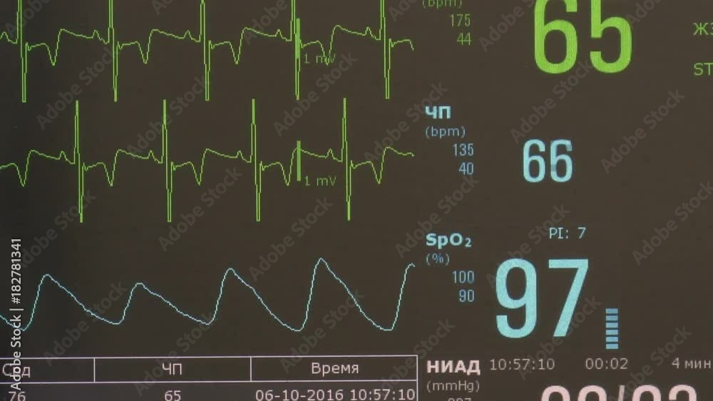 Cardiogram of rhythm of heart and pulse image on monitor during ...