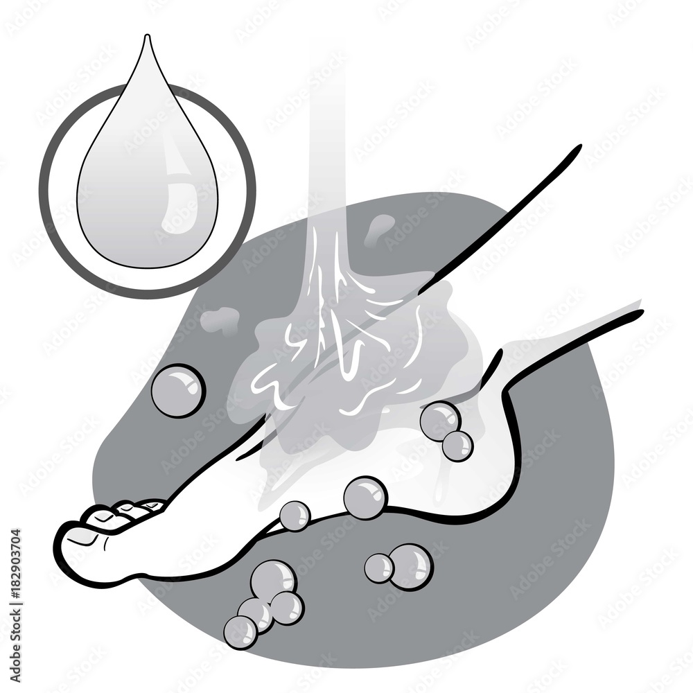 Illustration of First Aid, foot side view, rinsing or washing with ...
