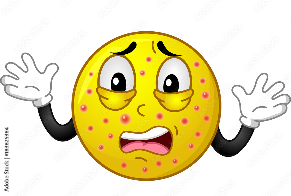 Mascot Smiley Chickenpox Illustration Stock Vector | Adobe Stock