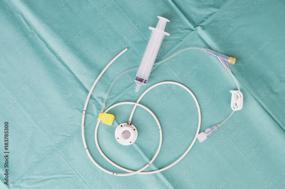 Port a catheter or central venous port insertion, puncture at chest ...