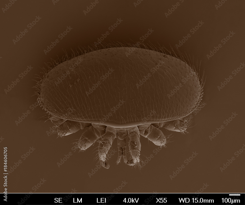 Varroa destructor bee parasite - an electron scanning microscope photo ...