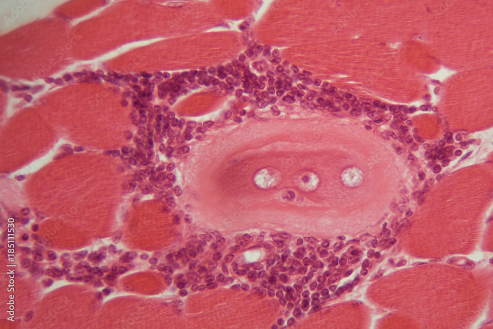 Trichinella spiralis larvae in muscle tissue under the microscope ...