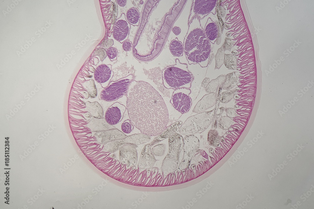 Parasitic nematode worm (Ascaris sp.) under the microscope Stock Photo ...