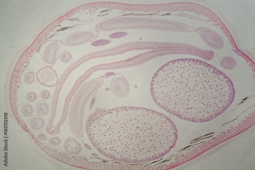 Parasitic nematode worm (Ascaris sp.) under the microscope Stock Photo ...
