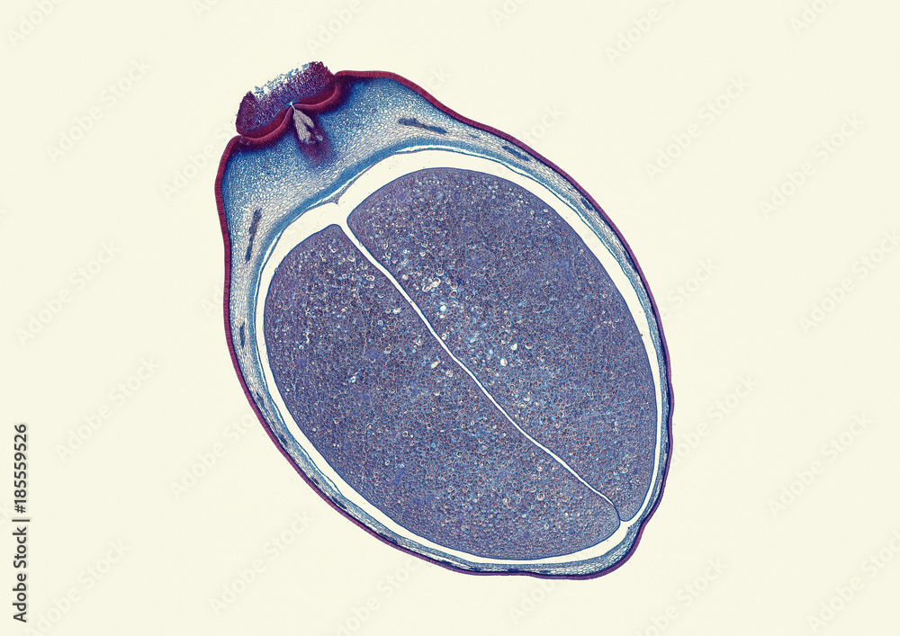 Phaseolus, bean, pod showing pericarp and seed - cross section cut ...