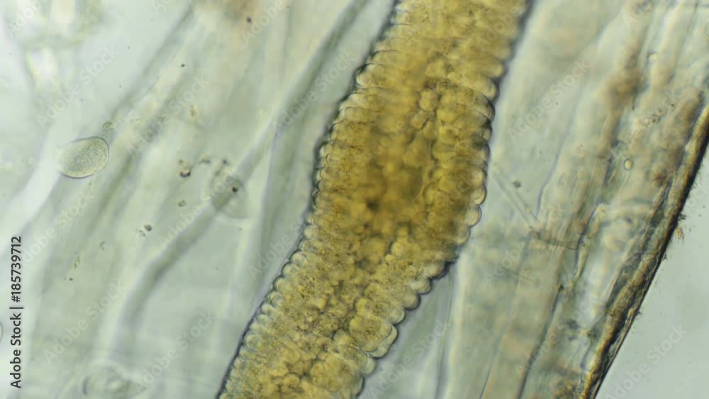 a transparent larva under the microscope,with internal organs,like an ...