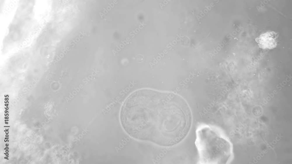 Vidéo Stock transparent microorganism under the microscope, with ...