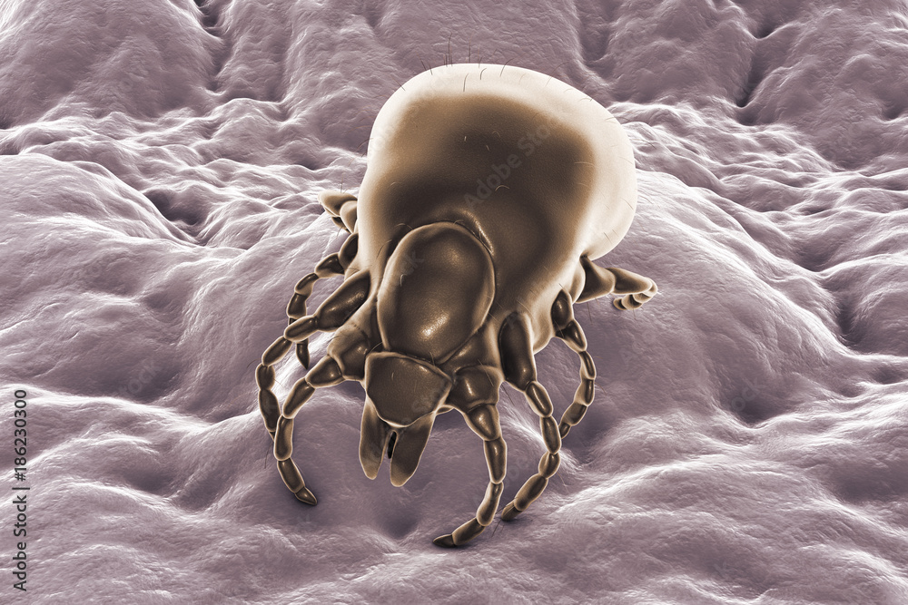 Tick Ixodes, an arthropod responsible for transmission of bacterium ...