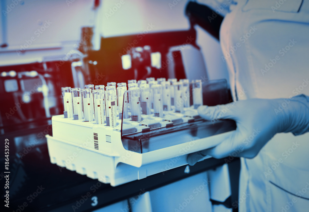 A scientist in a laboratory places test tubes with blood or urine in ...