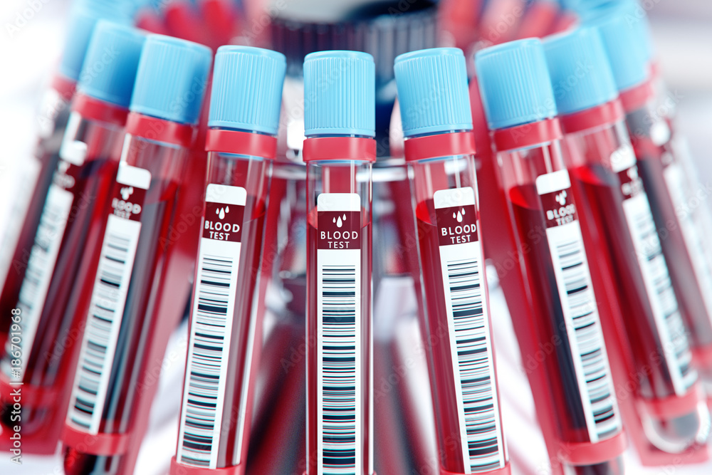 Lab equipment centrifuging blood. Concept image of a blood test.3d ...