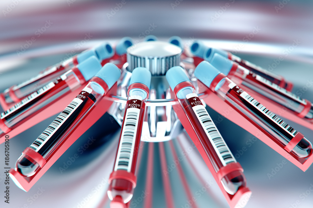 Lab equipment centrifuging blood. Concept image of a blood test.3d ...