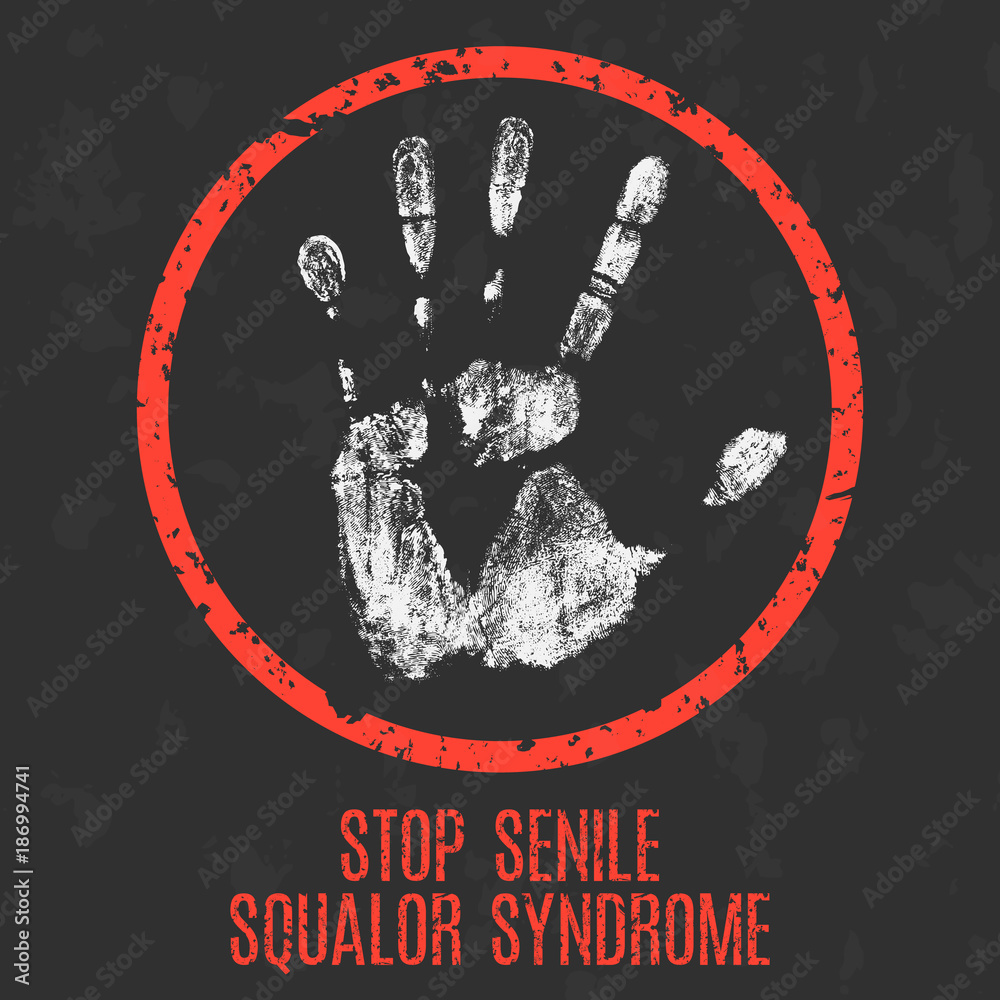 Squalor Syndrome