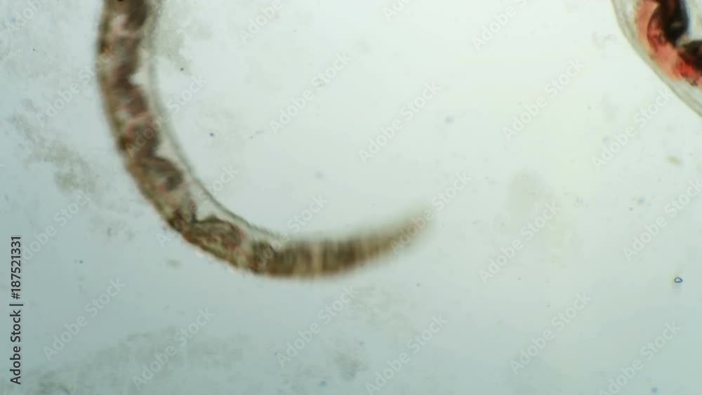 Vidéo Stock a transparent larva under the microscope, with internal ...