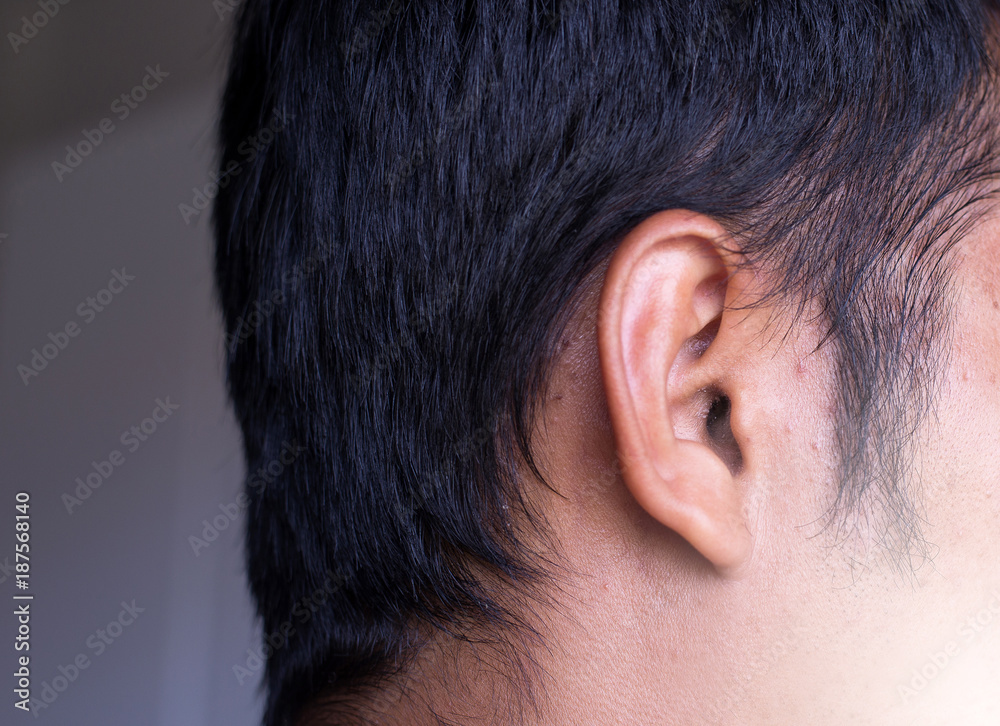 Earwax in ear close up,Healthcare and skin concept Stock Photo | Adobe ...