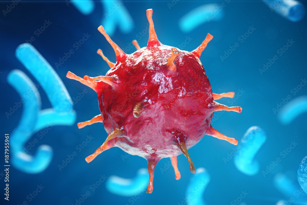 Viral hepatitis infection causing chronic liver disease, Hepatitis ...