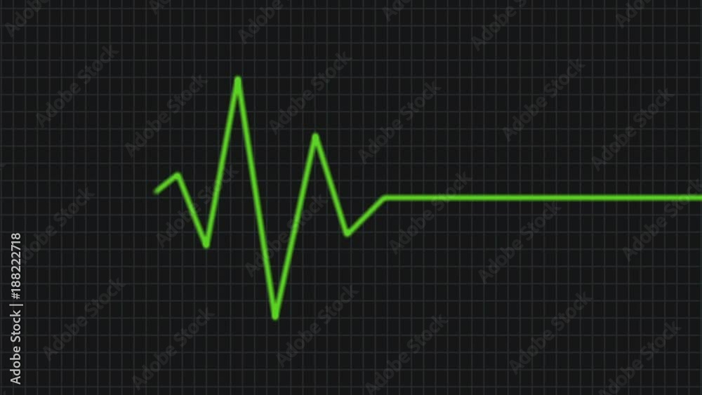Heart beat line in green on monitor - animation of heart ECG tracing ...