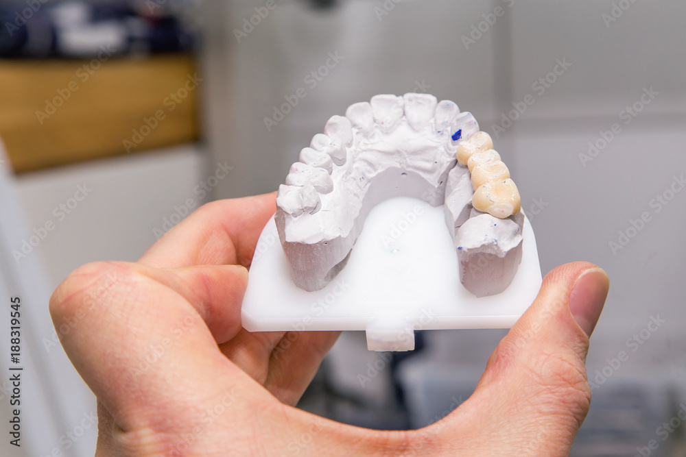 Technical shots of model on a dental prothetic laboratory Stock Photo ...