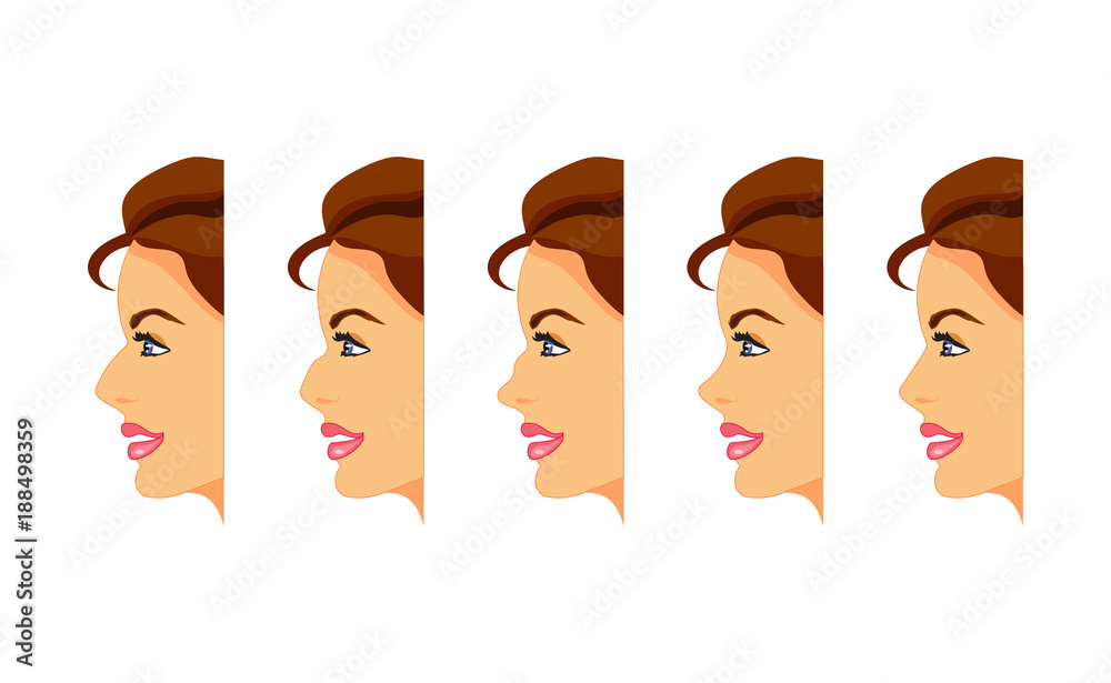 Types of nose Stock Vector | Adobe Stock