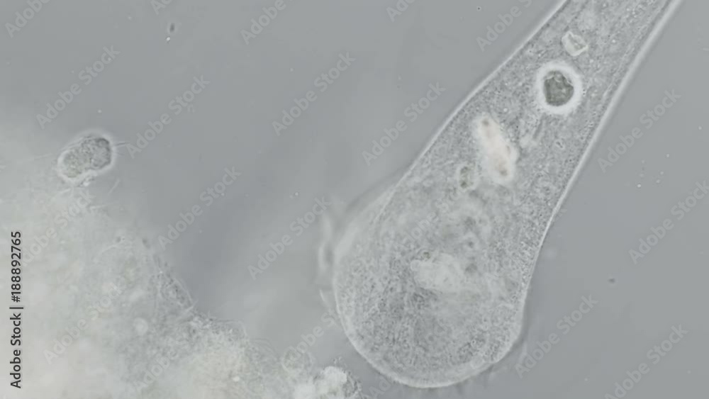 Vidéo Stock microorganisms,the inhabitants of the aquarium under the ...