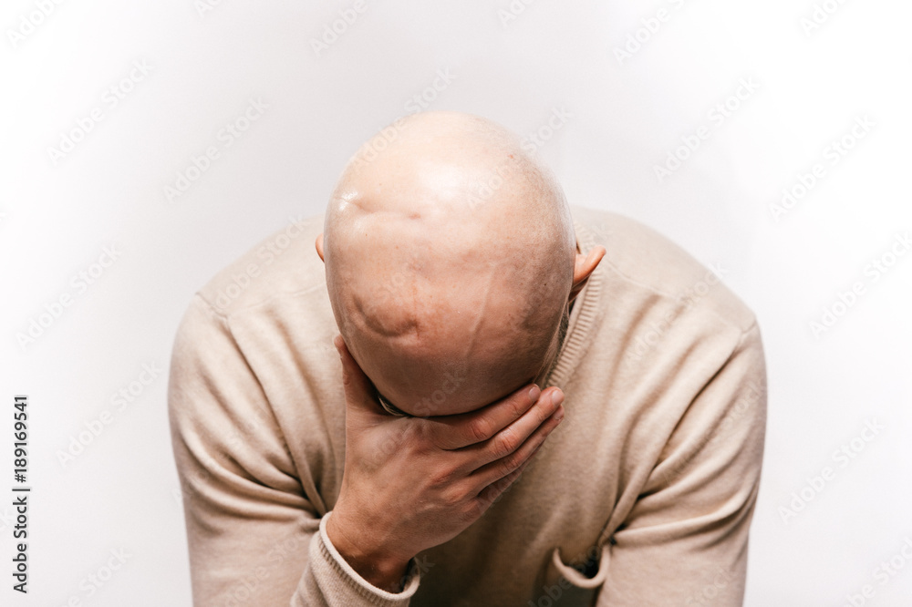 Foto de Bald man psychological stress struggling for life arter brain ...